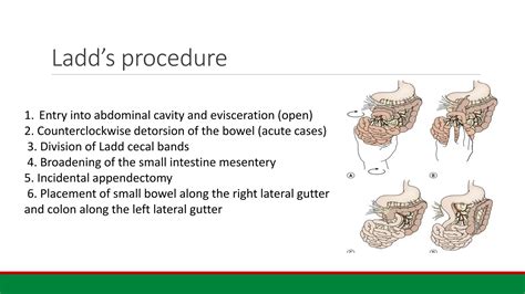 Neonatal Intestinal Obstruction Etiology Diagnosis And Managementpptx