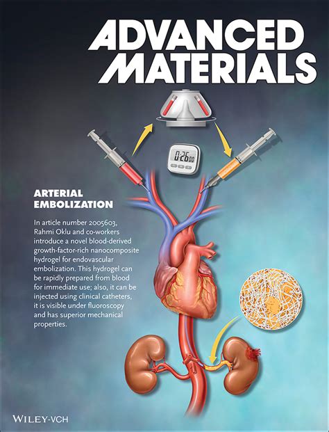 Arterial Embolization Blood‐derived Biomaterial For Catheter‐directed