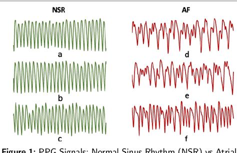 Figure 1 From Contrastive Self Supervised Learning Based Approach For Patient Similarity A Case