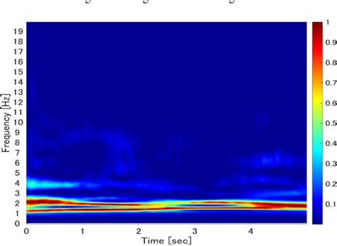 Figure 6 From A New Recognition Algorithm For Shockable Arrhythmias And