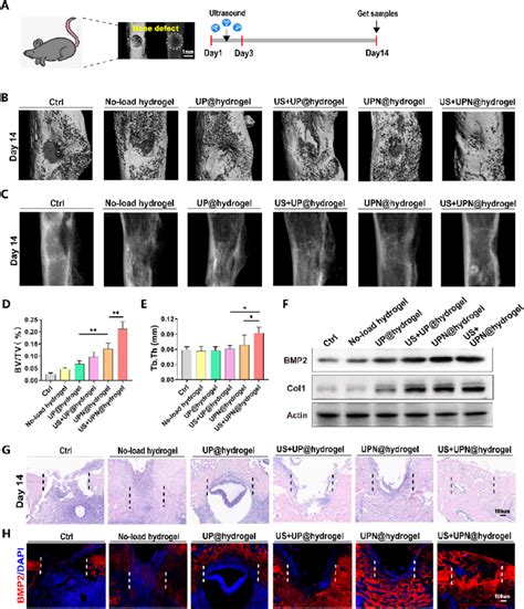 Ultrasound Responsive Upn Hydrogel Promotes Bone Defect Regeneration In