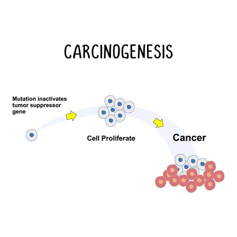 Carcinogenesis The Process Of Cancer Development 23108006 Vector Art