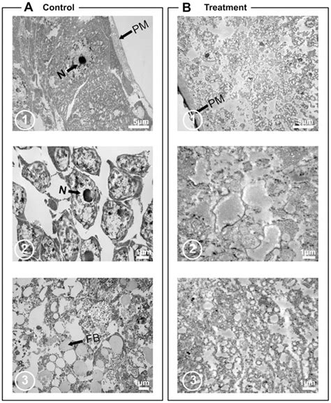 A1 A Control Larva Showed Well Developed Peritrophic Membrane Pm