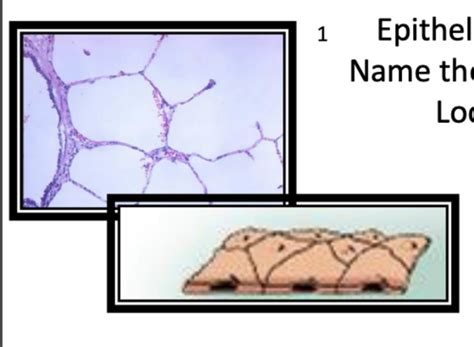 Bi 121 Lab Exam 1 Tissues Flashcards Quizlet
