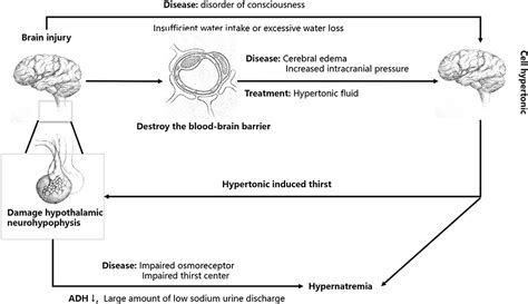Fluid Correction Hypernatremia At Angelica Mullins Blog