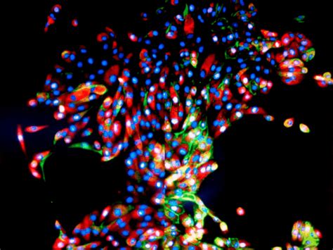 First Commercial Induced Pluripotent Stem Cell Plant Opens In Japan