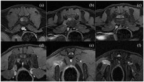 Neurolymphomatosis Caused By T Cell Lymphosarcoma In A Cat Imaging