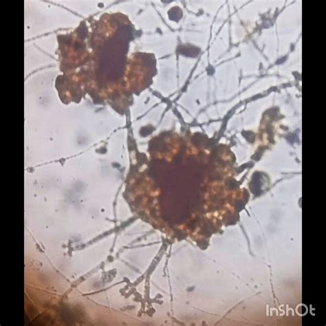 Apple Powdery Mildew Podosphera Dichotomous Branching Agriculture
