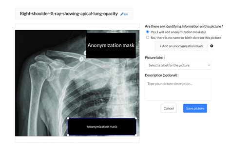 An Even Smarter Ecrf For More Efficient Data Collection