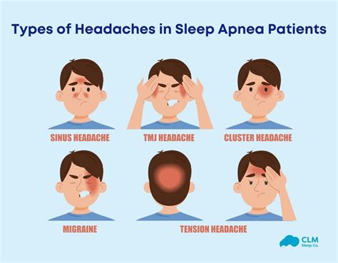 Area Of Brain Headache Sleep