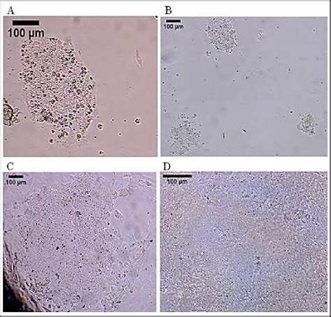 Induced Pluripotent Stem Cell Culture A C Colonies Of Ipscs D
