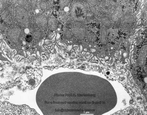 Glycogen Granules Drjastrows Electron Microscopic Atlas