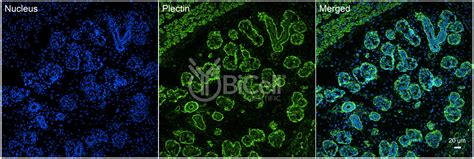 Plectin Plec Antibody Bicell Scientific®