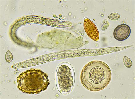 Parasites In Stool
