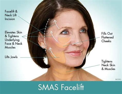 Facelift Thousand Oaks Facelift Surgery Westlake Village