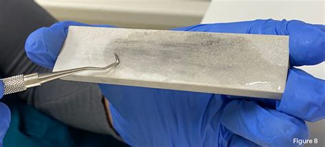 Dental Instruments—keep Your Skills Sharp Aaha