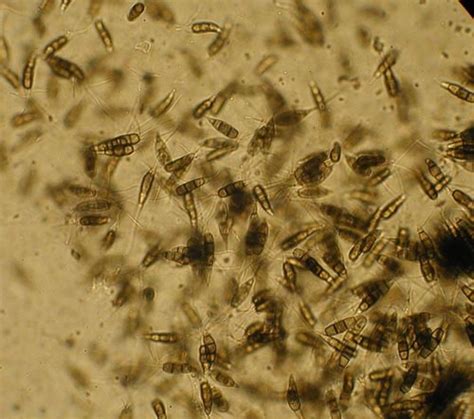 Arborvitae Thuja Occidentalis Tip Blight Pacific Northwest Pest Management Handbooks