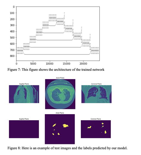 Github Rutasnim Covid Lung Lesion Seg Nnu Net Network On Covid Lung Ct Lesion Data