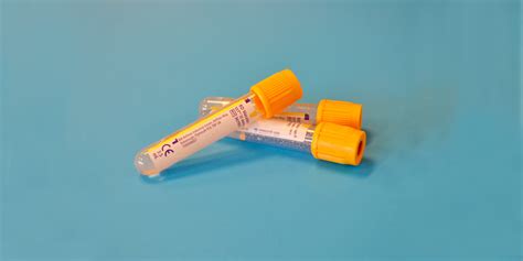 How Progesterone Affects Fertility Femometer