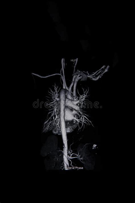 扫描血管造影从胶片射线拍摄照片图片 包图网企业站