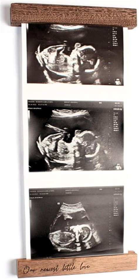 Oscar Bee Sonogram Picture Frame Ultrasound Keepsake For