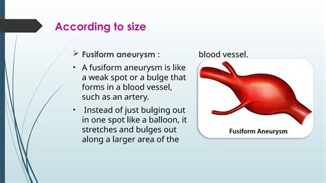 Aneurysm Classification Of Aneurysm And Causes Of Aortic Aneurysm Pptx