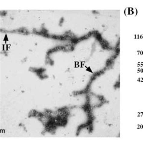 A Transmission Electron Micrograph Of Native Intermediate Filament