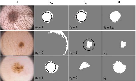 the results of the skin detection and the lesion segmentation processes