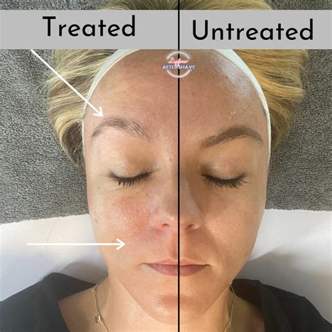 Pro Review Of Star T Shocks 2 Areas Face Tummy Results