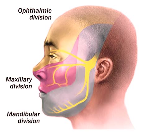 Trigeminal Neuralgia Treatment Vitality Chiropractic