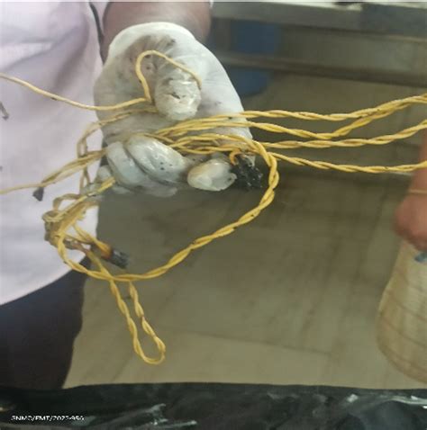 Ligature Material Obtained Round The Neck Download Scientific Diagram