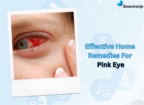Effective Home Remedies For Pink Eye