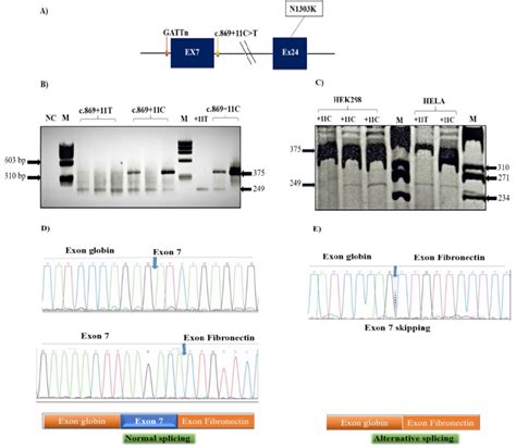 Splicing Patterns Of Examined Complex Alleles From Different Patients