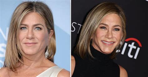 Jennifer Anistons Tired Face Is Due To Botched Filler Surgeon Claims