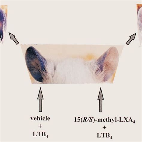 Transcellular Lipoxin Biosynthesis Illustration Of The Three Main