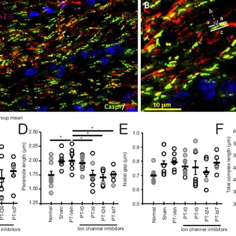 The Effects Of Partial Optic Nerve Transection Pt And Immediate Or