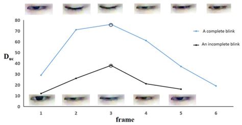 Sensors Special Issue Biosignal Sensing And Processing For Clinical