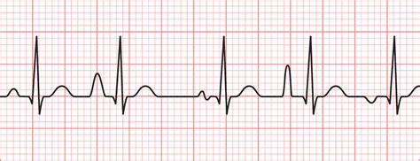 Free Basic Electrocardiogram Qanda