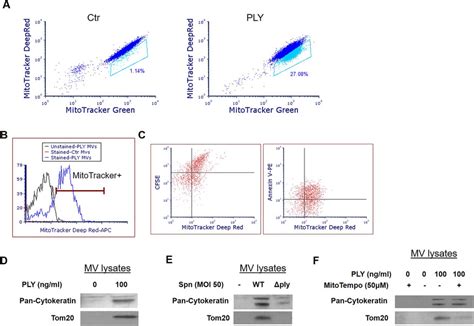 Pneumolysin Ply Triggers The Release Of Microvesicles Mvs Carrying
