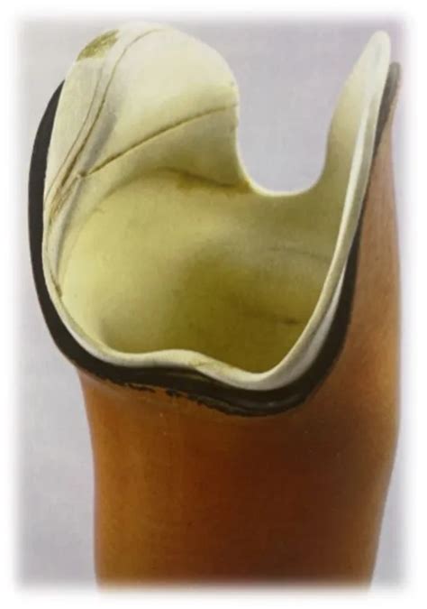 Suspension Methods For Below Knee Prosthetics Explained — Tillges