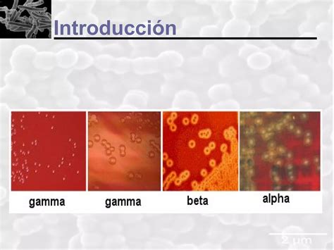 Streptococcus Agalactiae Ppt