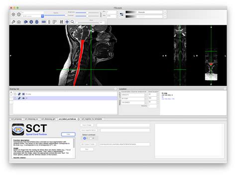Consider Using Fsleyes Plugin As Wrapper For The Shimming Toolbox · Issue 205 · Shimming