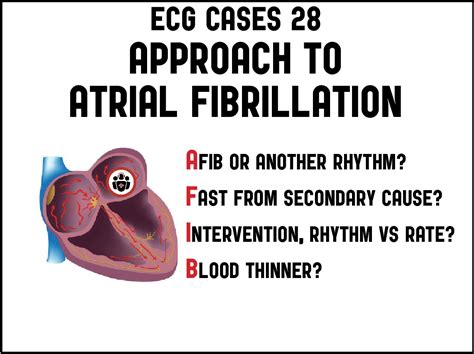 Afib With Rvr Treatment