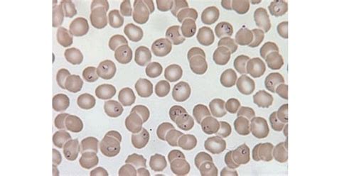 Plasmodium