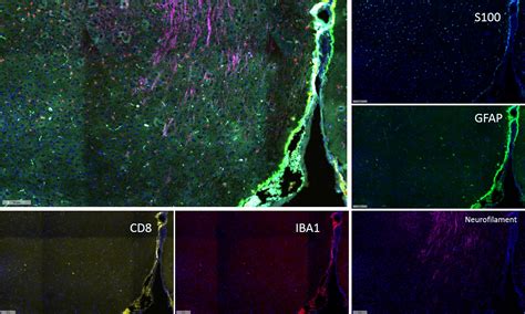 Mouserabbit Dual Target Three Color Fluorescence Detection Kit