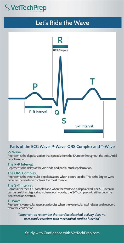 Infographic Parts Of The Ecg Wave Artofit
