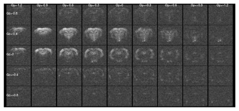 Asymmetric Spin Echo Data In A Single Slice At τ 56 Ms As For Figure
