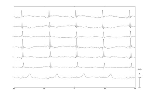Source Components For Subject 1 Download Scientific Diagram