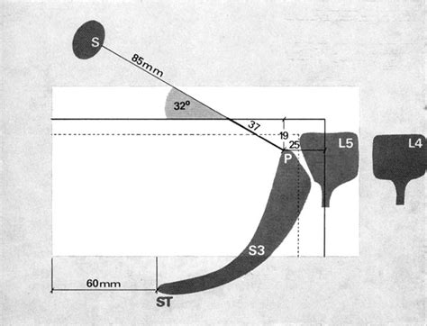 The Relationship Between The Target Volume And The Pelvic Structures Download Scientific