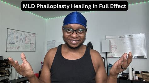 Bottom Surgery Recovery Is A Lot Update Transman Ftm Phalloplasty